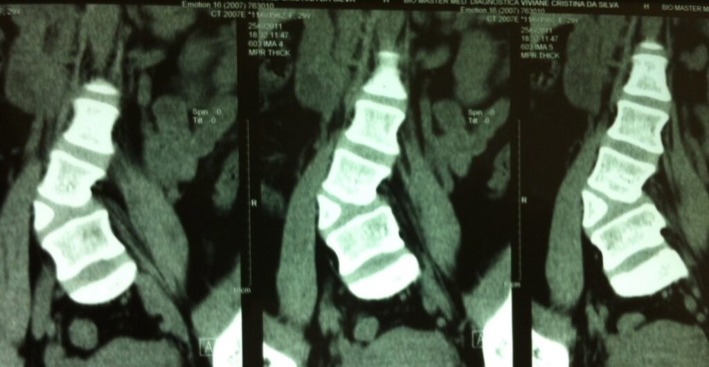 Malformações - Dr. Bruno César Aprile